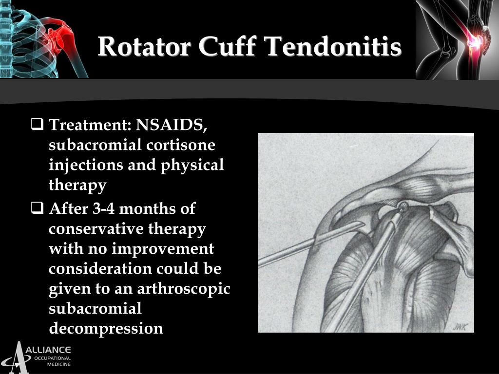 PPT - Shoulder and Knee Injury: Treatment and Prevention PowerPoint ...