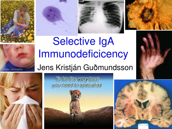 PPT - Selective IgA Immunodeficicency PowerPoint Presentation, free ...