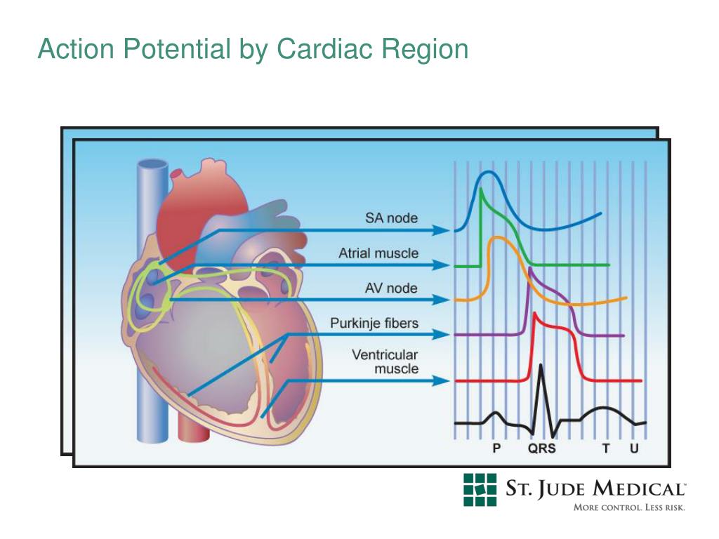 PPT - The Electrical Management of Cardiac Rhythm Disorders Tachycardia ...