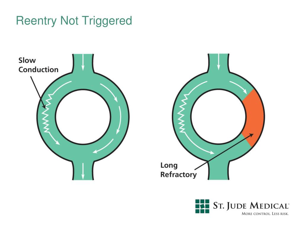 PPT - The Electrical Management of Cardiac Rhythm Disorders Tachycardia ...