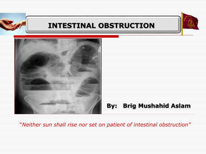 PPT - INTESTINAL OBSTRUCTION PowerPoint Presentation, free download ...