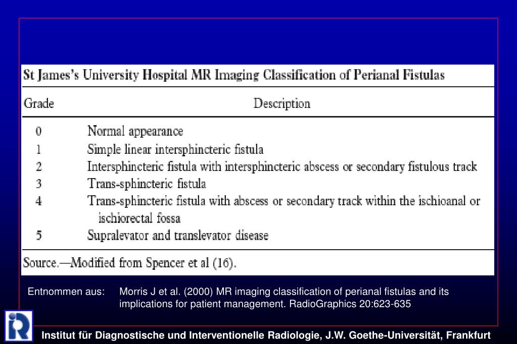 PPT - MR-morphologische Einteilung der perianalen Fisteln PowerPoint ...