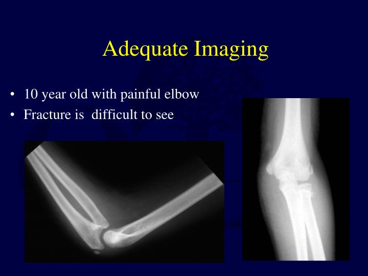 PPT - Growth Plate Injuries PowerPoint Presentation - ID:3508194