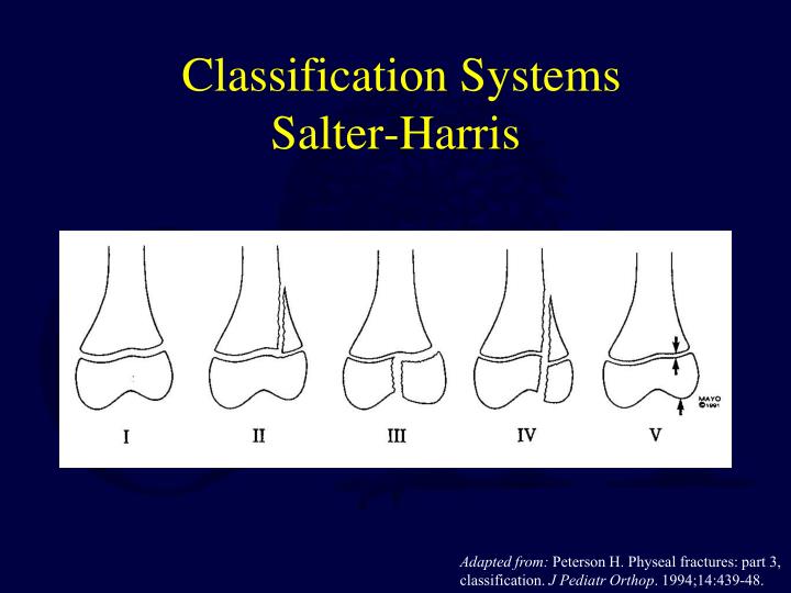 PPT - Growth Plate Injuries PowerPoint Presentation - ID:3508194