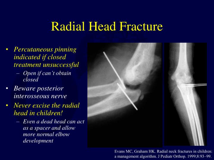 PPT - Growth Plate Injuries PowerPoint Presentation - ID:3508194
