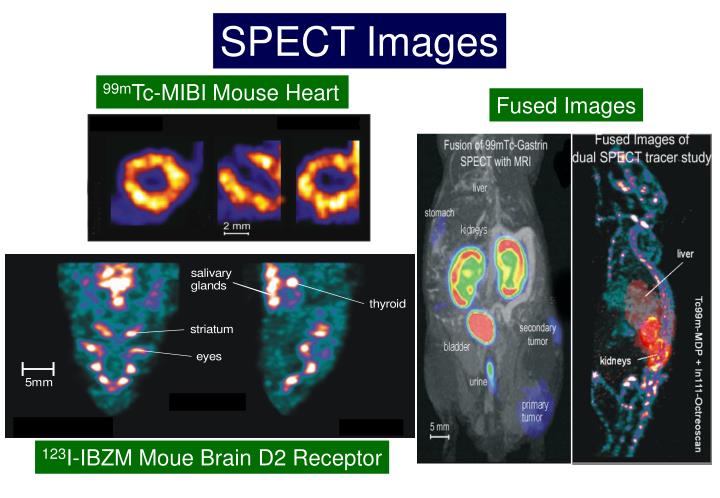PPT - Molecular Imaging PowerPoint Presentation - ID:3508749