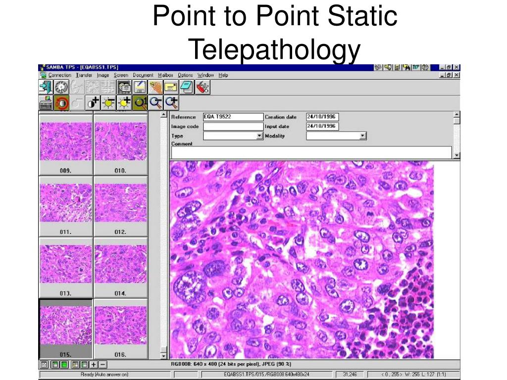PPT - Telepathology, Teledematolgy & Teledermatology PowerPoint ...