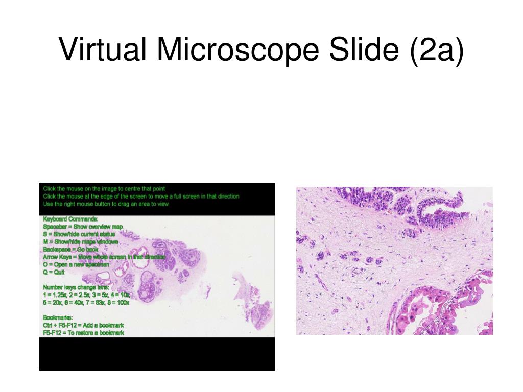 PPT - Telepathology, Teledematolgy & Teledermatology PowerPoint ...