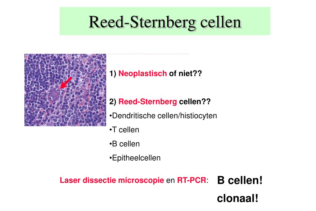 PPT - Hodgkin lymfoom Blok 4 oncologie, oktober 2011 PowerPoint ...