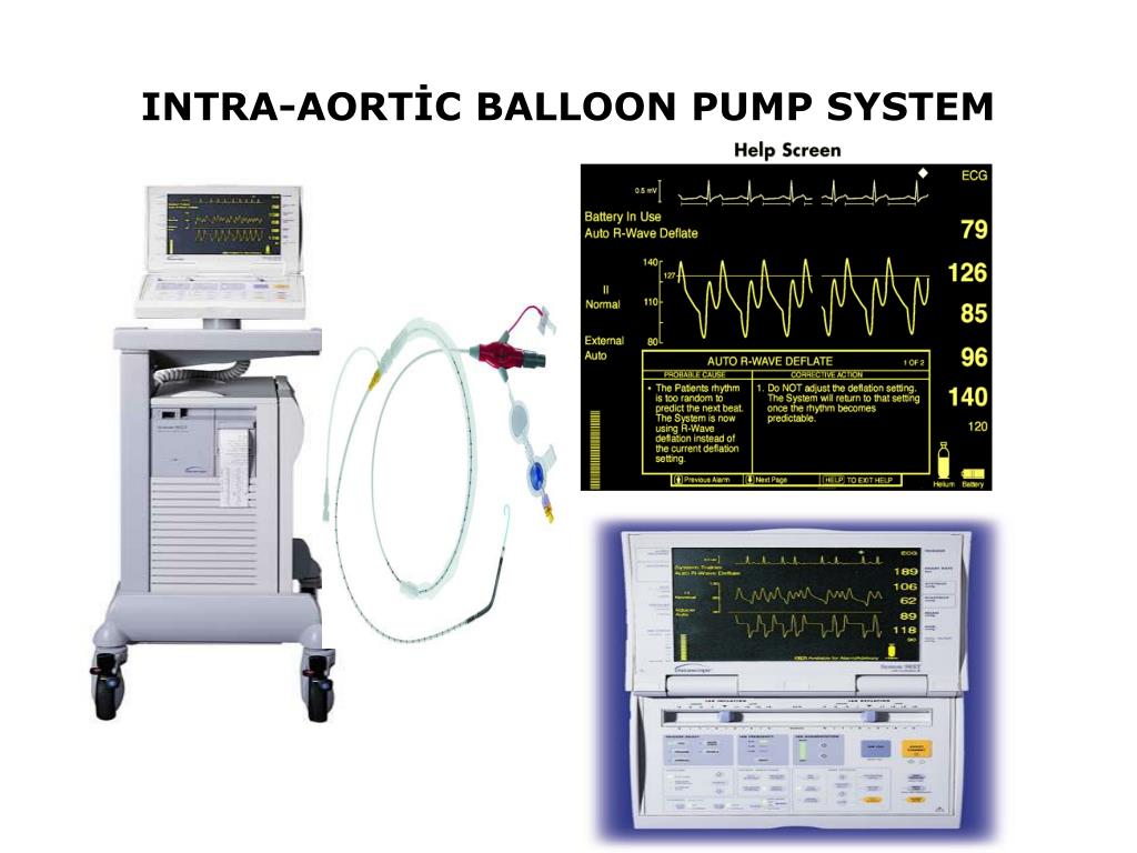 PPT - Ekstra Korporal Yaşam Desteği 2 extracorporeal life support IABP ...