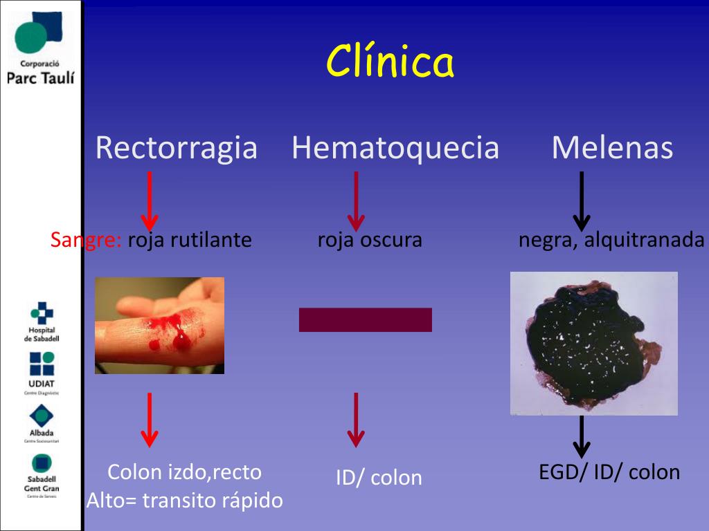 PPT - Manejo del paciente con hemorragia digestiva baja PowerPoint ...