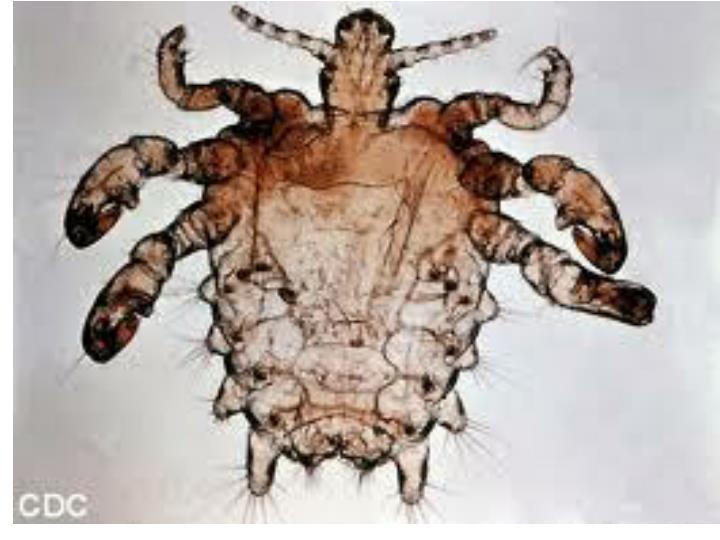 PPT - Body lice before feeding PowerPoint Presentation, free download ...
