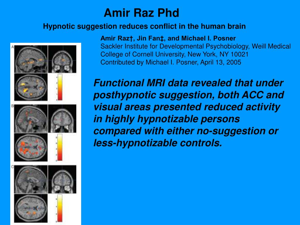 PPT - Hypnosis and Irritable Bowel Syndrome Head or Gut? Nashville 2010 ...