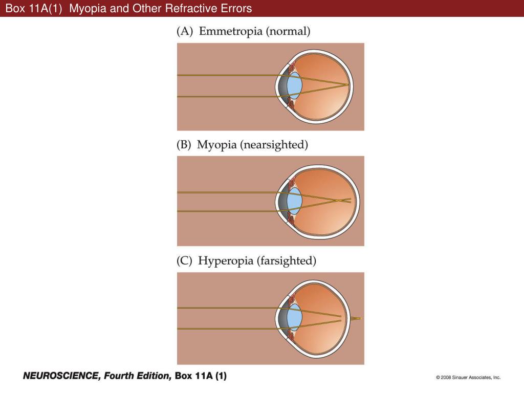 PPT - Figure 11.1 Anatomy of the human eye PowerPoint Presentation ...