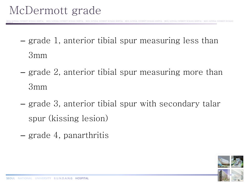 PPT - Ki Hyuk Sung, MD Department of Orthopaedic Surgery Seoul National ...