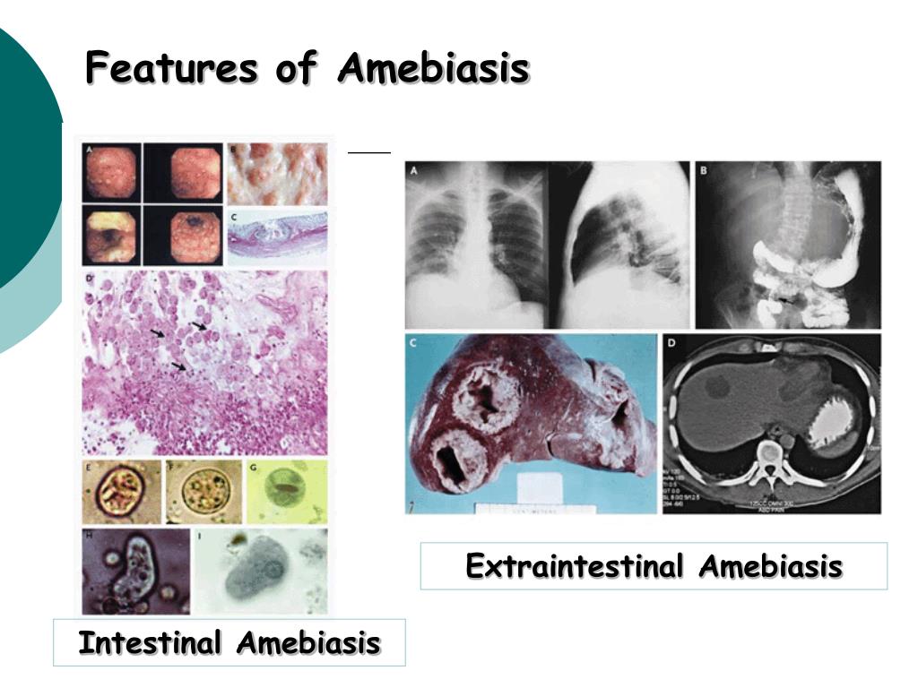 PPT - Anti-amebiasis and anti-trichomoniasis drugs ( 抗阿米巴病和抗滴虫病药 ...