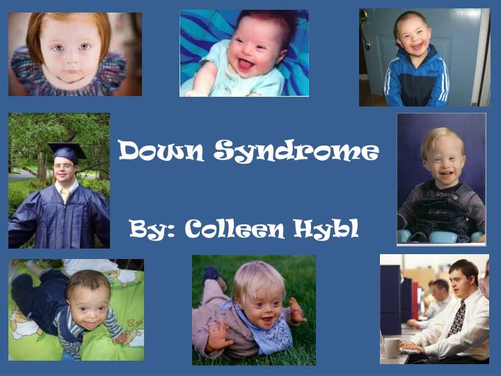 PPT - Down Syndrome PowerPoint Presentation, free download - ID:3514969