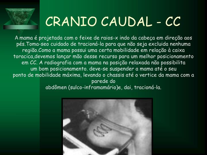 PPT - MAMOGRAFIA PowerPoint Presentation - ID:3517883