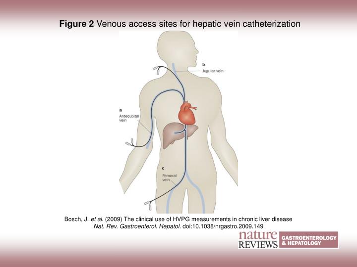 PPT - Figure 2 Venous access sites for hepatic vein catheterization ...