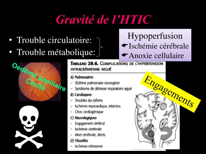 PPT - PHYSIOPATHOLOGIE DE L’HYPERTENSION INTRA-CRANIENNE (HTIC ...