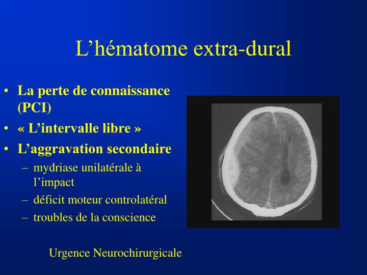 PPT - LE TRAUMATISME CRANIEN de la PCI au Trauma Grave PowerPoint ...