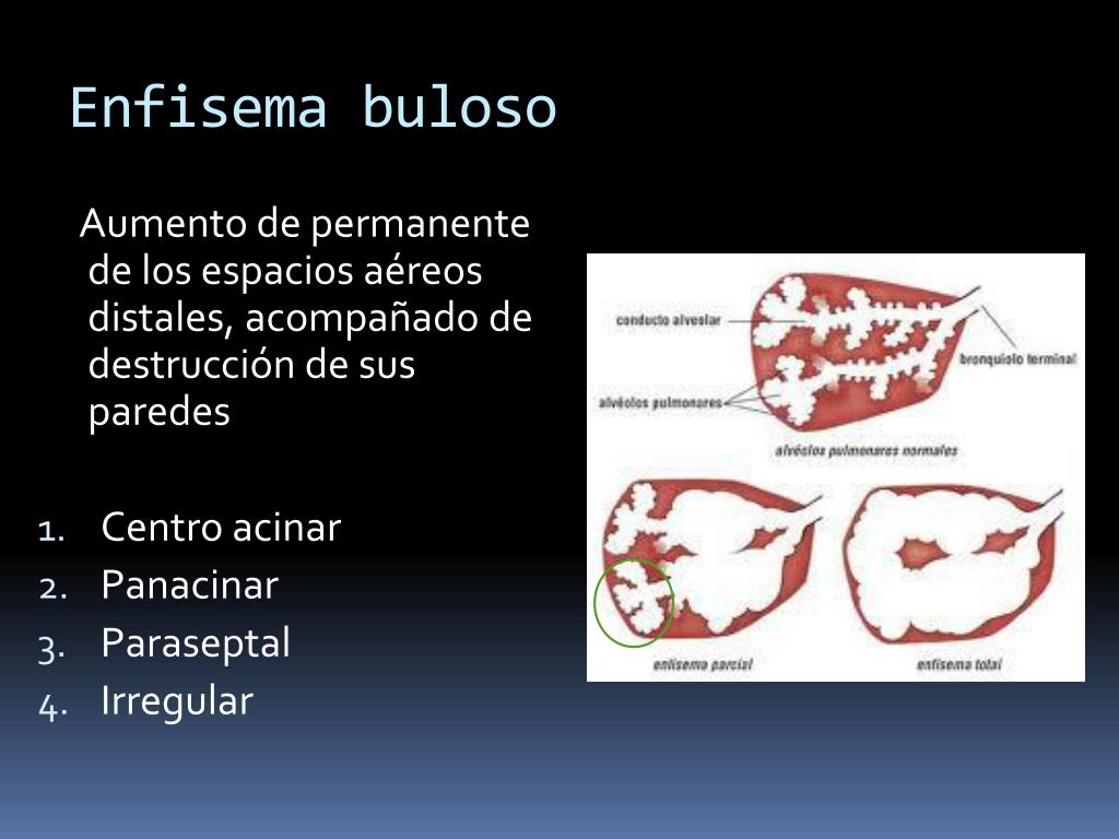 PPT - Caso ilustrativo para medicina perioperatoria PowerPoint ...