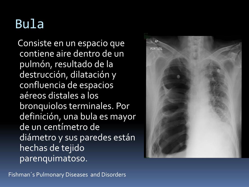 PPT - Caso ilustrativo para medicina perioperatoria PowerPoint ...