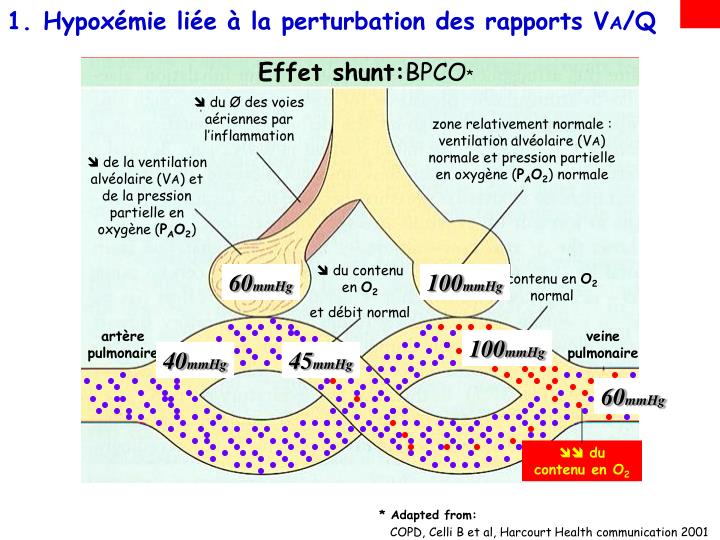 PPT - Insuffisance Respiratoire Chronique Définitions et ...