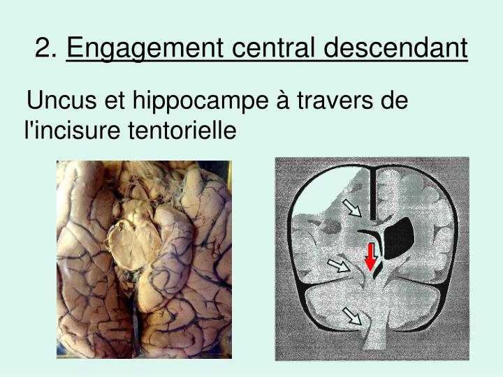 PPT - Œdème cérébral PowerPoint Presentation - ID:3525193