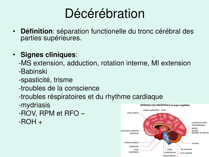 PPT - Œdème cérébral PowerPoint Presentation - ID:3525193