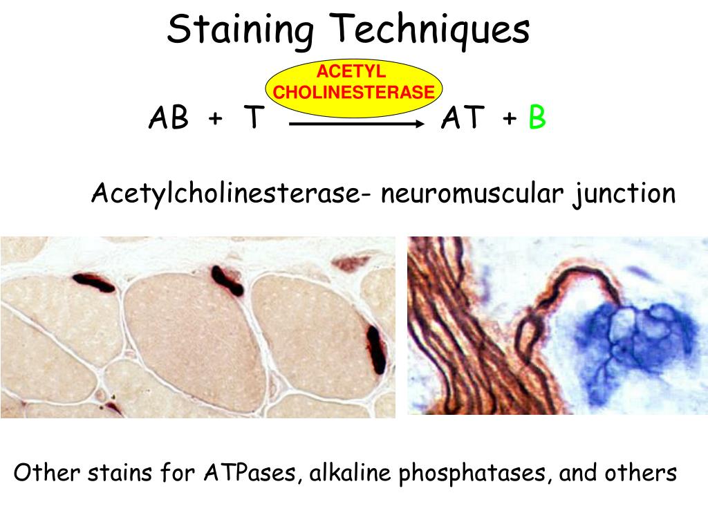 PPT - Staining Techniques Histochemical Stains: involve chemical ...