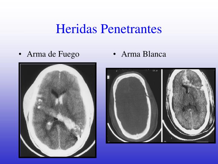 Ppt Trauma De Cráneo Powerpoint Presentation Id 3526500
