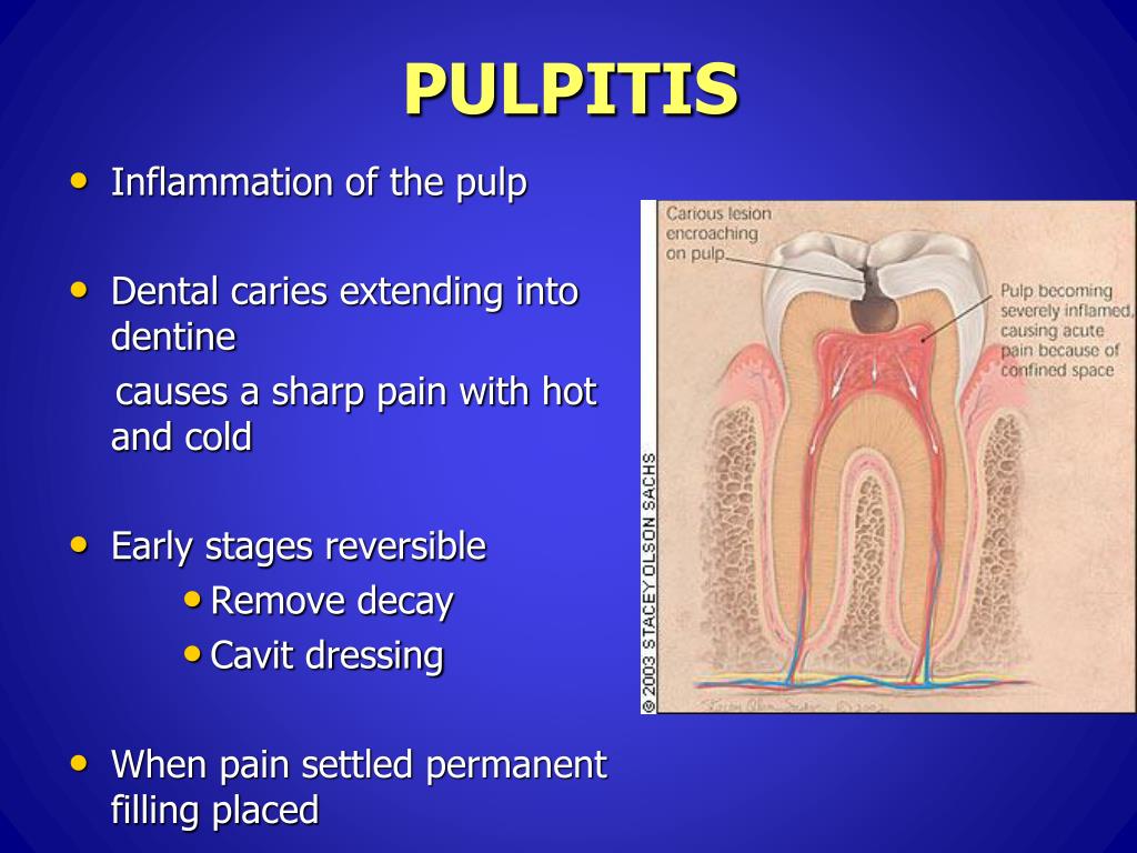 PPT - MANAGING DENTAL EMERGENCIES March 24, 2011 Lianne Beck, MD ...