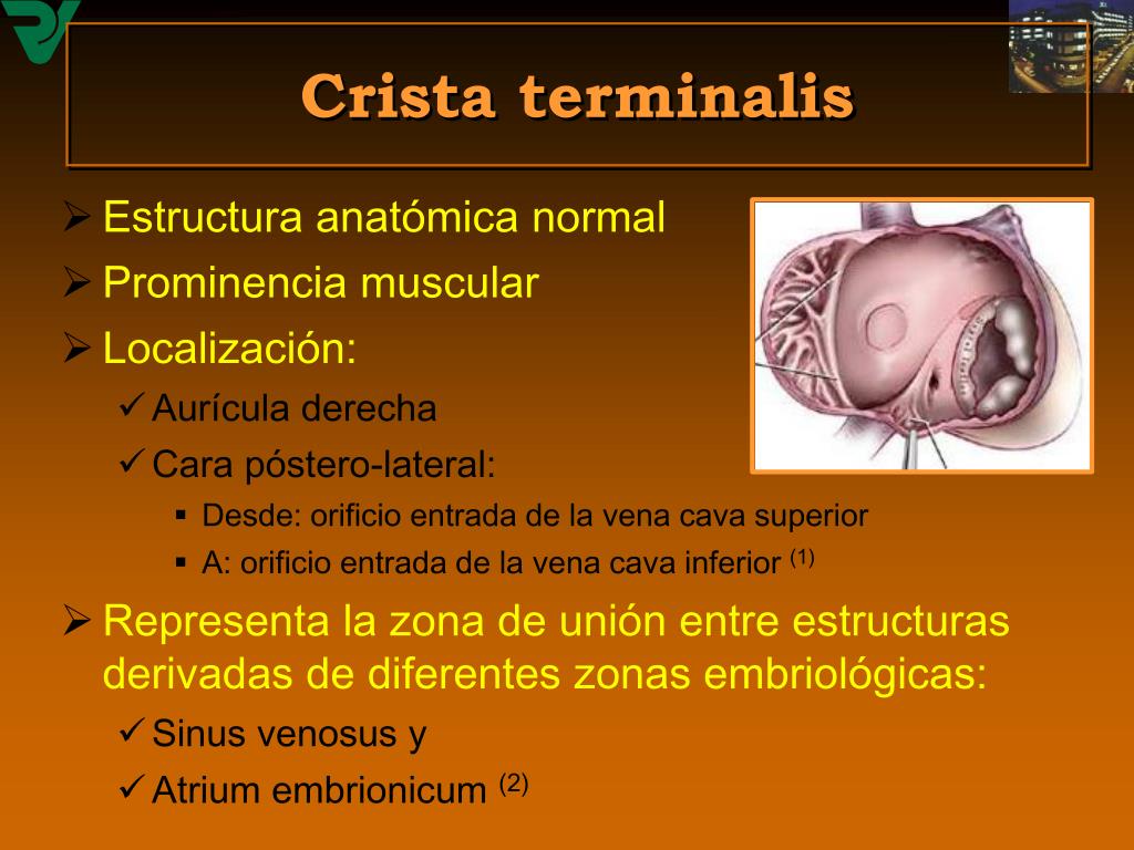 PPT - Introducción PowerPoint Presentation, free download - ID:3526796