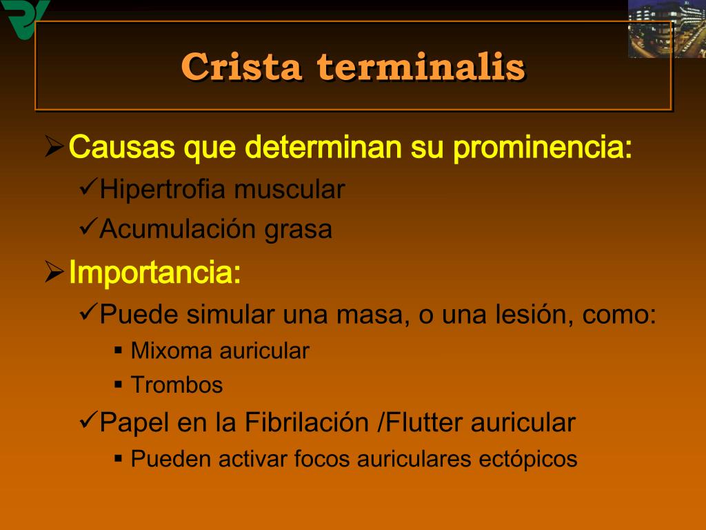 PPT - Introducción PowerPoint Presentation, free download - ID:3526796