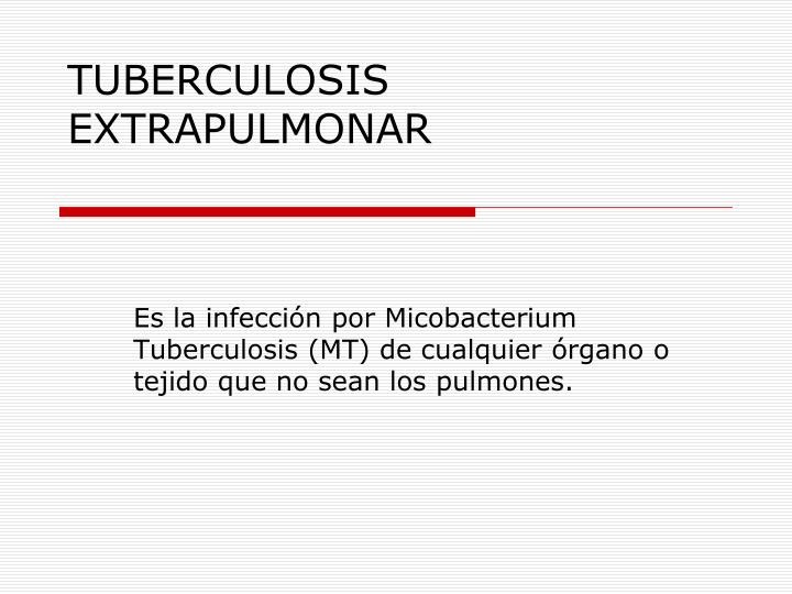PPT - TUBERCULOSIS EXTRAPULMONAR PowerPoint Presentation - ID:3529624