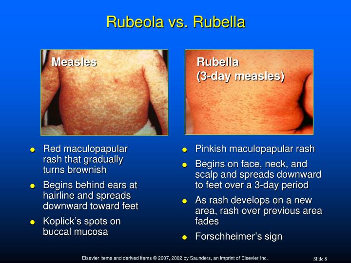 Rubella Rash Images