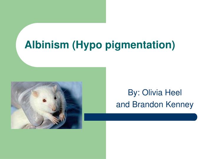PPT - Albinism (Hypo pigmentation) PowerPoint Presentation, free ...