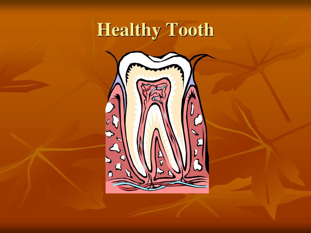 PPT - Diabetes and Dental Health PowerPoint Presentation, free download ...