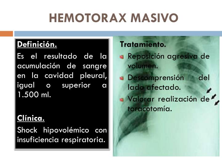PPT - TRAUMA DE TORAX PowerPoint Presentation - ID:3534641
