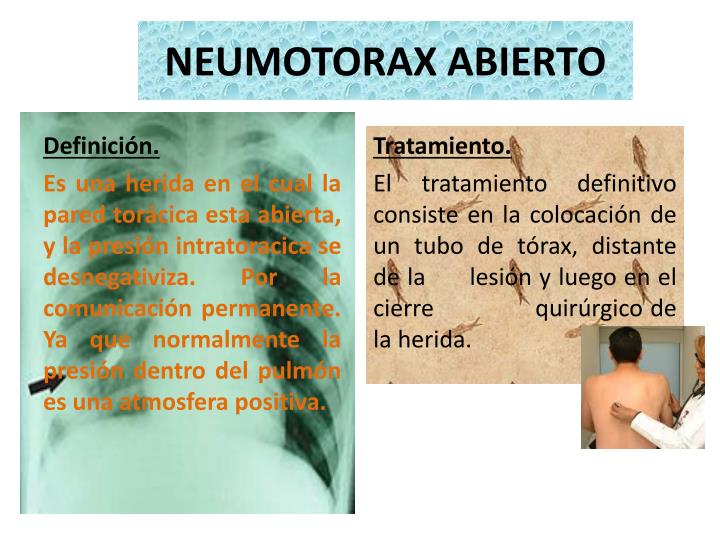 PPT - TRAUMA DE TORAX PowerPoint Presentation - ID:3534641