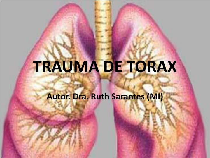 PPT - TRAUMA DE TORAX PowerPoint Presentation, free download - ID:3534641