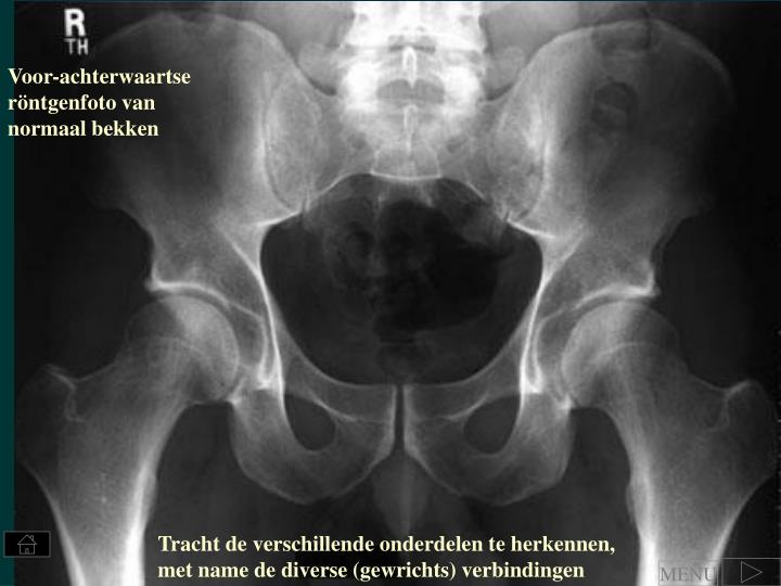 PPT - BEKKEN en HEUPGEWRICHT PowerPoint Presentation - ID:3535716