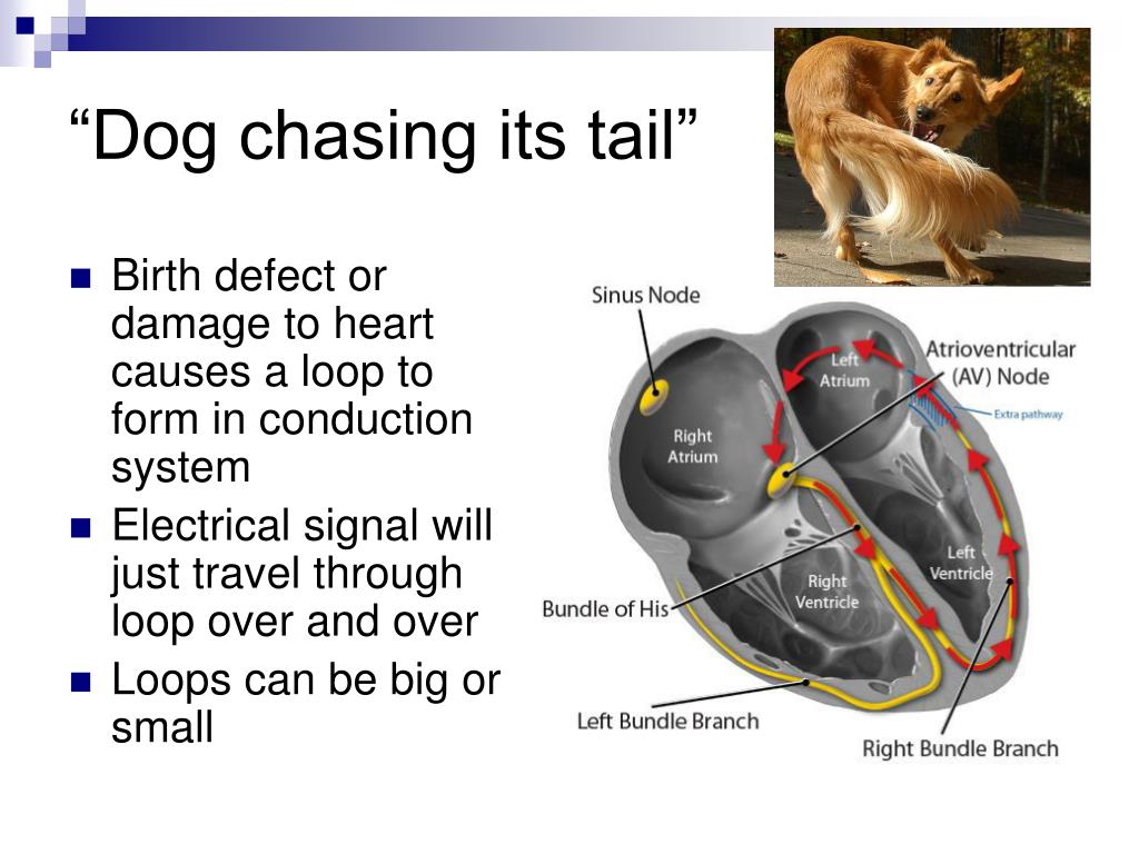 PPT - The “Befores” and “Afters” of Arrhythmias and Hypertrophic ...