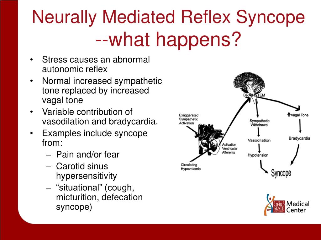 Ppt Syncope Evaluation And Management Powerpoint Presentation Free