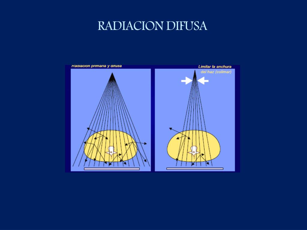 PPT - RADIOLOGIA GENERALIDADES FACULTAD DE MEDICINA univERSIDAD SAN ...