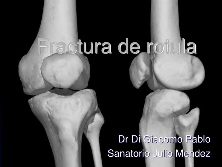 PPT - Fractura de rotula PowerPoint Presentation, free download - ID ...
