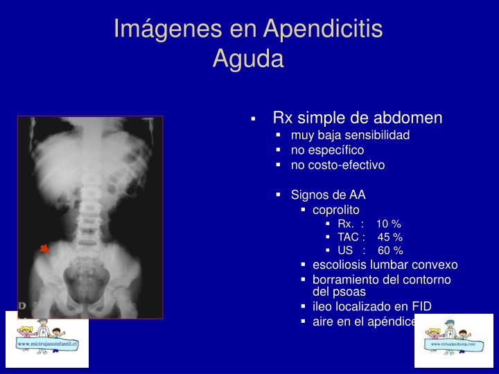 PPT - Abdomen Agudo: Claves del diagnóstico Diferencial PowerPoint ...