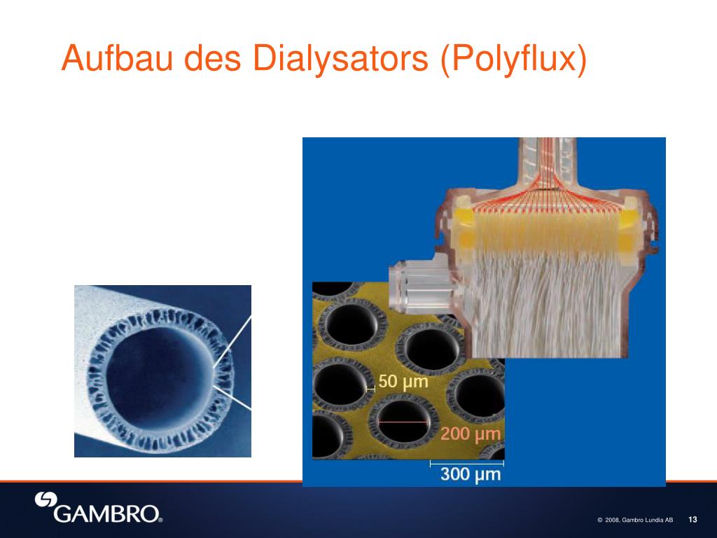 PPT - Neue Entwicklungen bei Dialysatoren Ein Beitrag zur Verbesserung ...