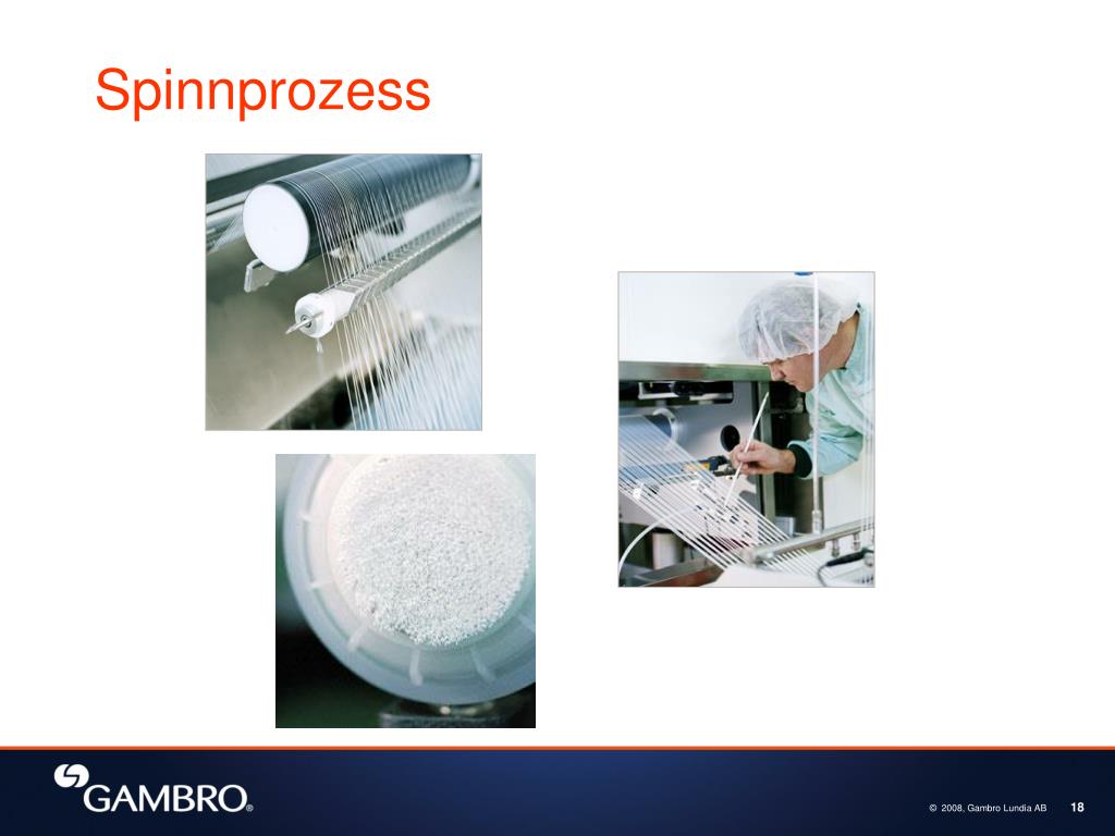 PPT - Neue Entwicklungen bei Dialysatoren Ein Beitrag zur Verbesserung ...